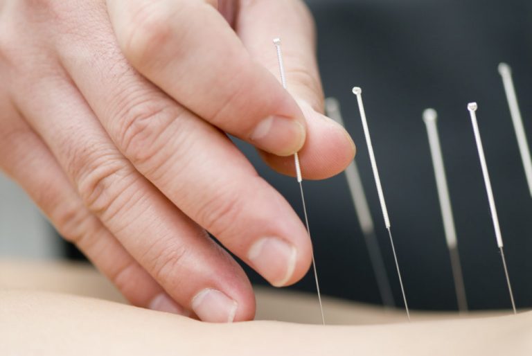 Acupuncture for Post-Stroke Recovery | Haynes Acupuncture Gold Coast